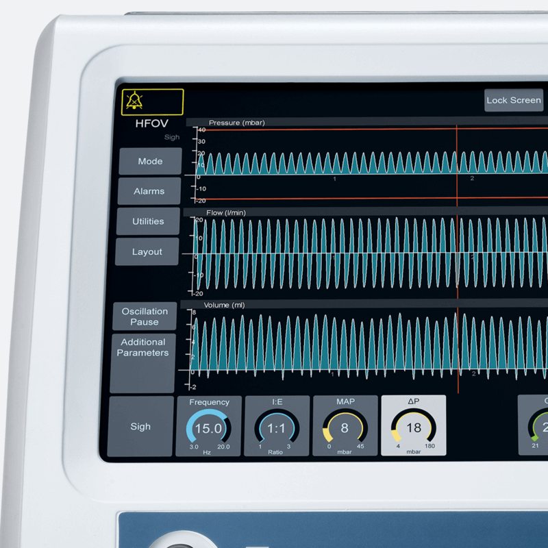 High Frequency Oscillation Ventilation - Inspiration Healthcare
