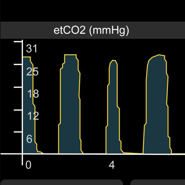 etCO2 - Inspiration Healthcare