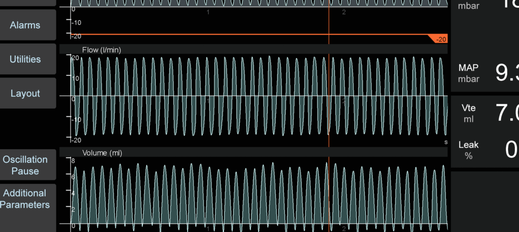High Frequency Oscillation Ventilation - Inspiration Healthcare